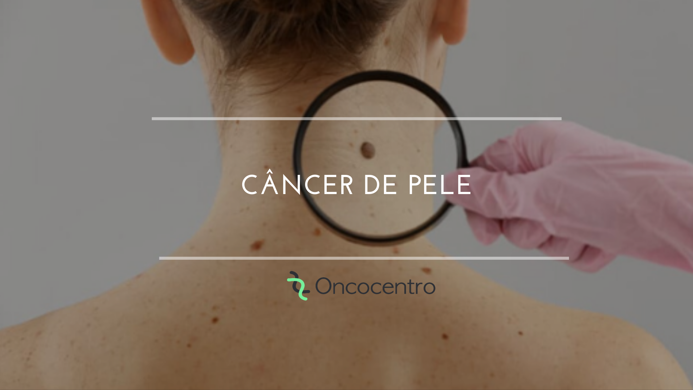 Câncer de pele | Oncocentro Câncer de pele | Oncocentro