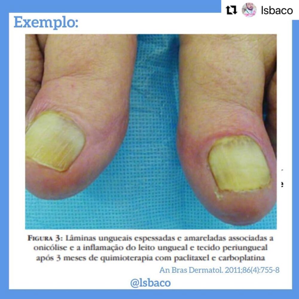 çõ?? ???????? ?? Câncer de Mama | Oncocentro