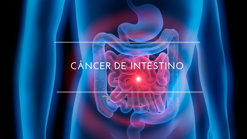 Colorretal | Oncocentro