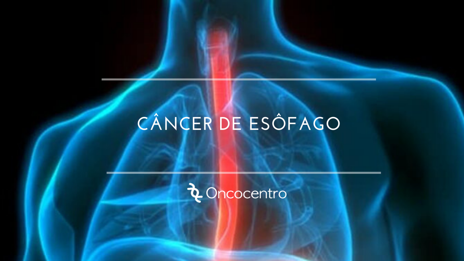 Câncer de Esôfago | Oncocentro